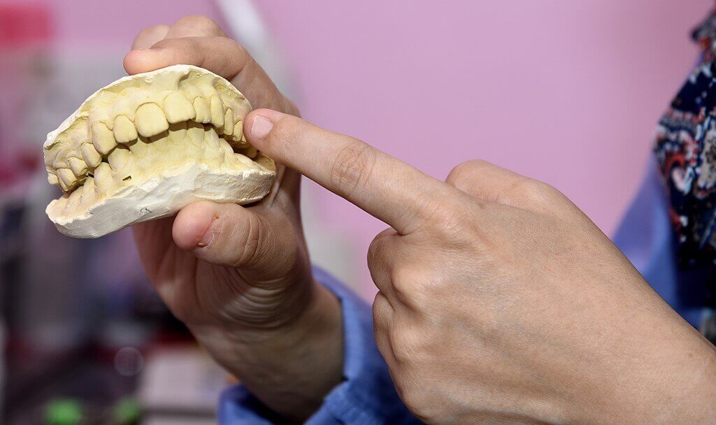 Waspada Pendakap Gigi Tiruan! - Malaysiaaktif